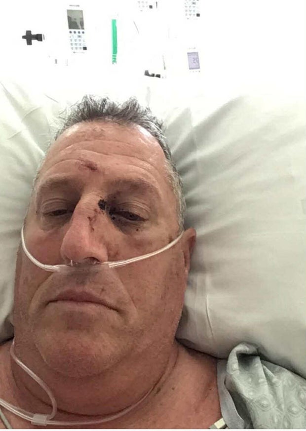 Massachusetts State Police trooper nearly killed in Revere hit-and-run ...