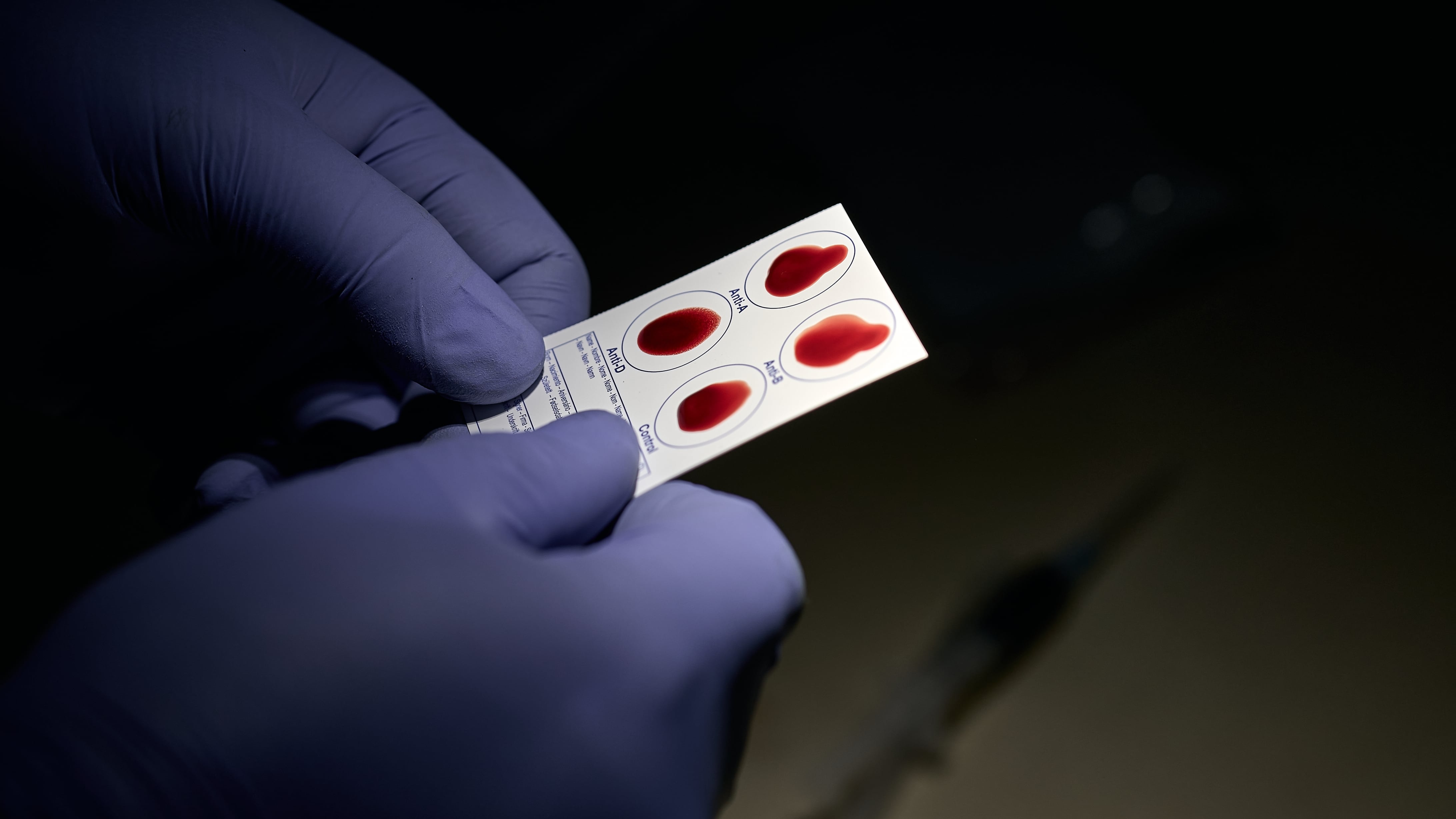 A New, Ultra-Rare Blood Type Found in Only One Woman