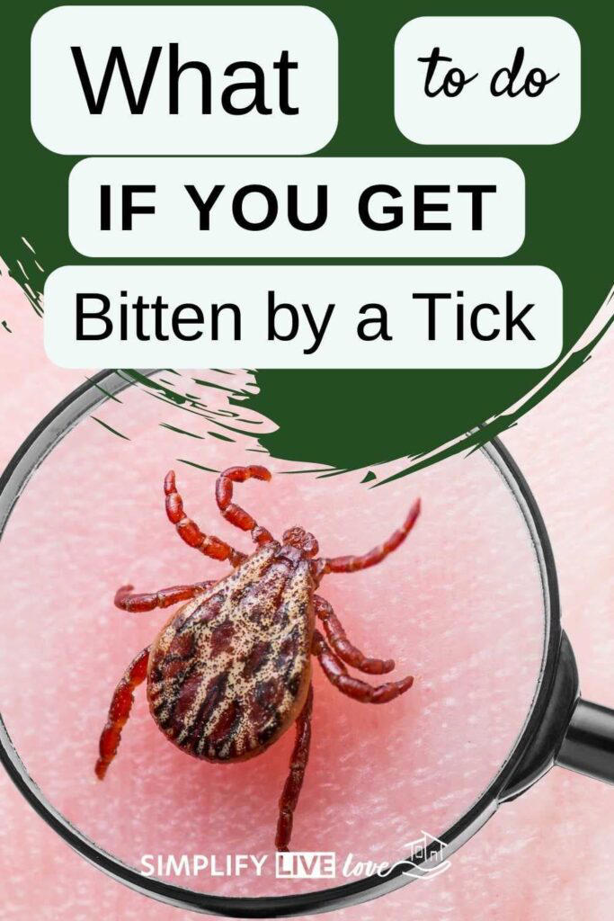 What to Do If You Are Bitten by a Tick (+ When to Worry)
