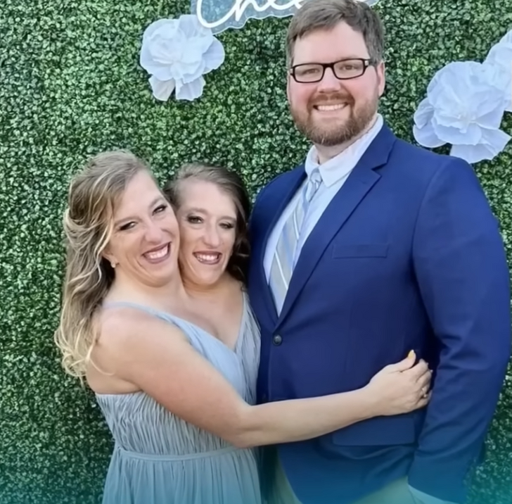 “I’m Just Confused!” One of the Famous Conjoined Twins Got Married ...