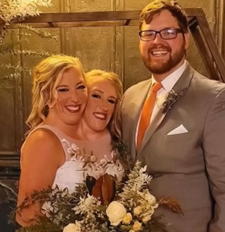 “I’m Just Confused!” One of the Famous Conjoined Twins Got Married ...
