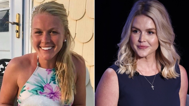 Did Karoline Leavitt Get A Nose Job? Cosmetic Expert Tells Us Giveaway