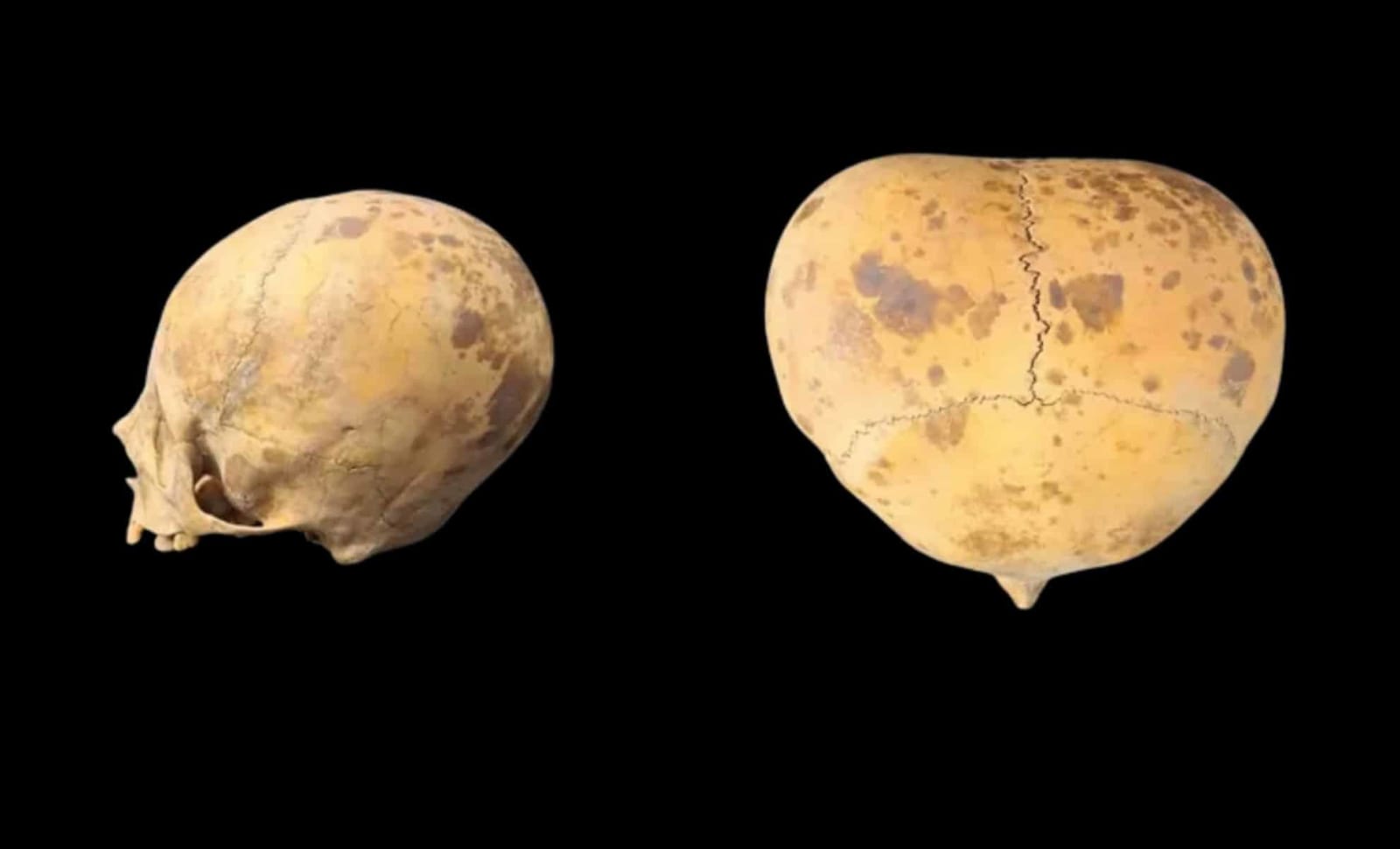 A Strange Skull in Argentina Sparks Alien Theories – But the Real Story ...