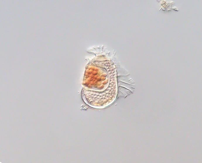 What is life? A little microbe raises big questions.