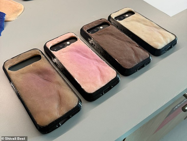 Creepy phone case burns like human SKIN when exposed to UV