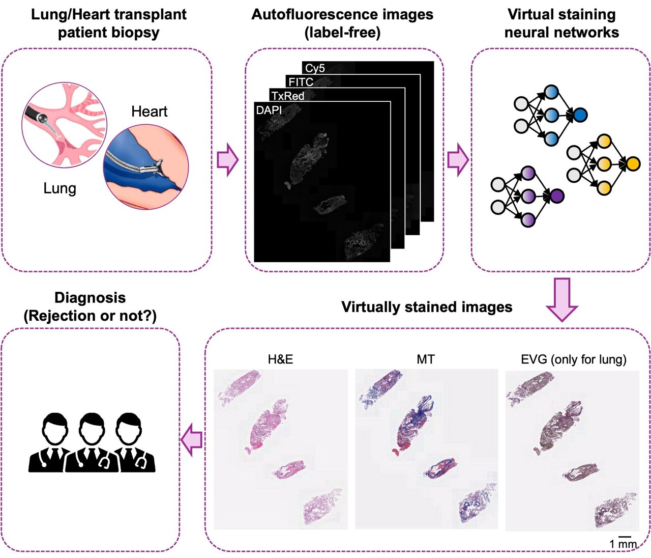 AI-powered virtual staining of biopsies for transplant diagnostics