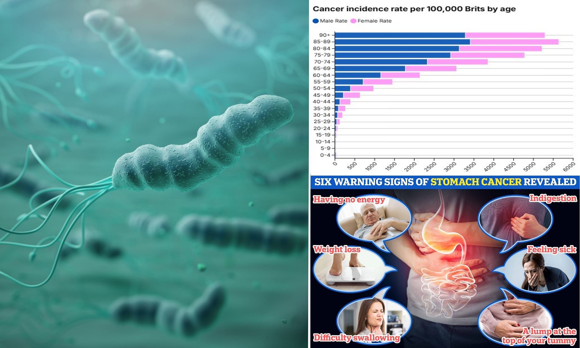 Doctors warn millions of people will be diagnosed with stomach cancer ...