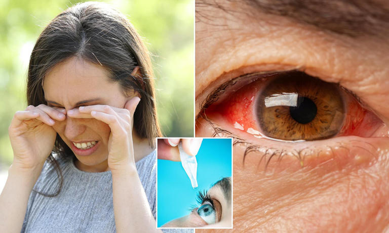 Urgent warning issued as drug chiefs recall common eye drops due to ...