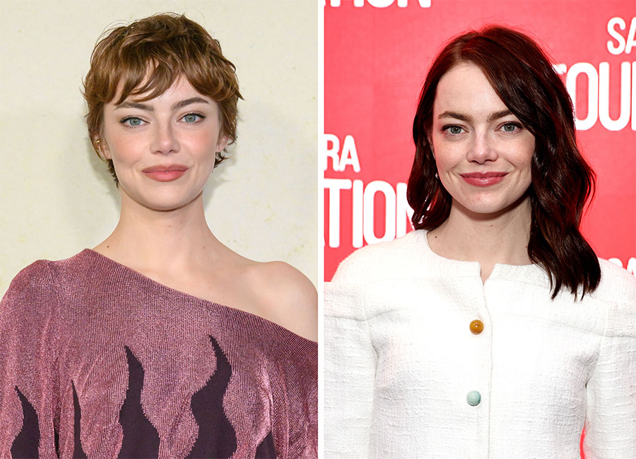 Did Emma Stone have the plastic surgery that Irish people are getting ...