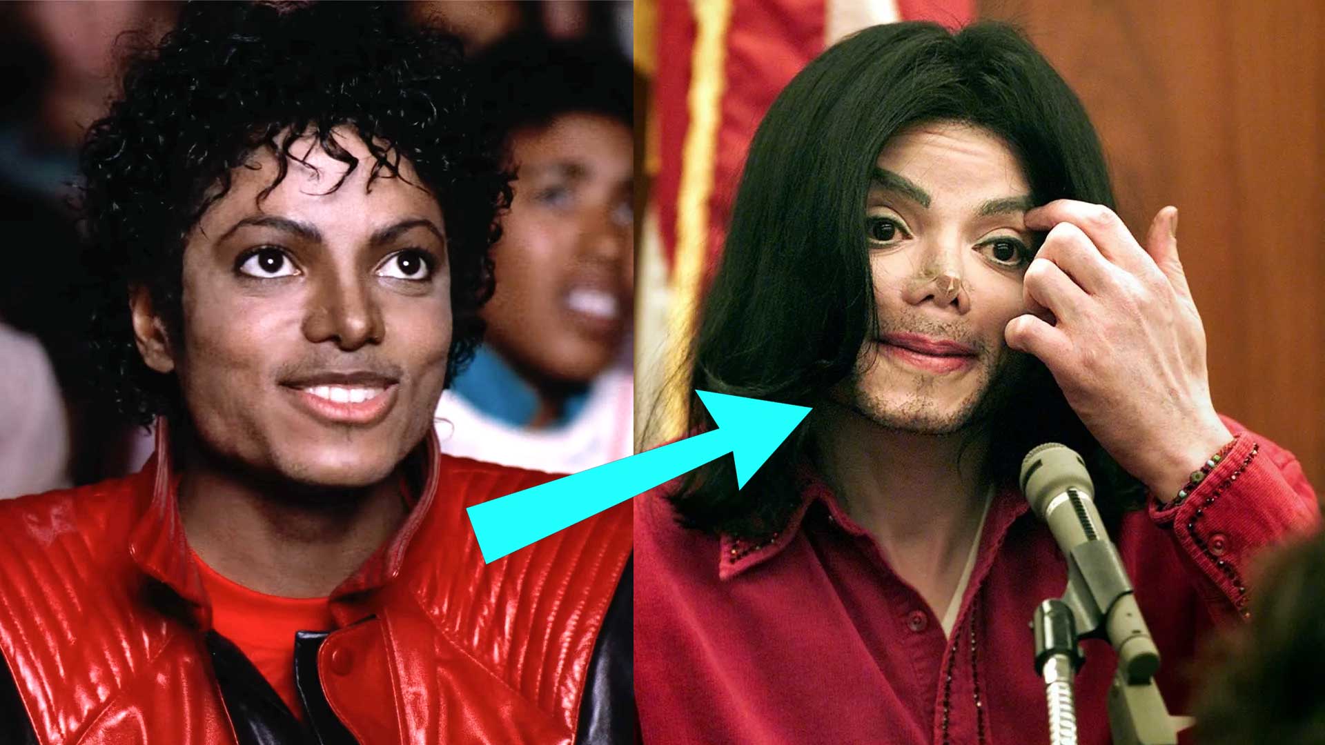 Before & After: When Cosmetic Surgery Crosses the Line