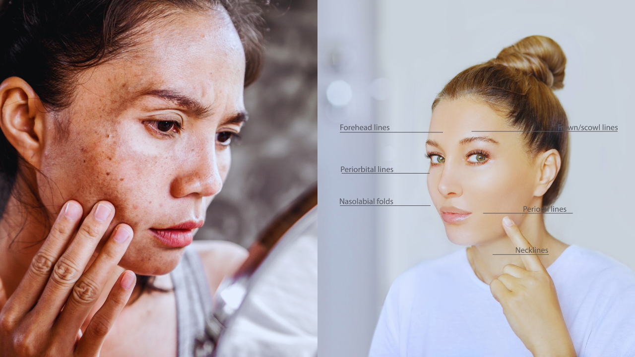 Why Dermatologists Treat What They See, Not What is on Your Birth ...