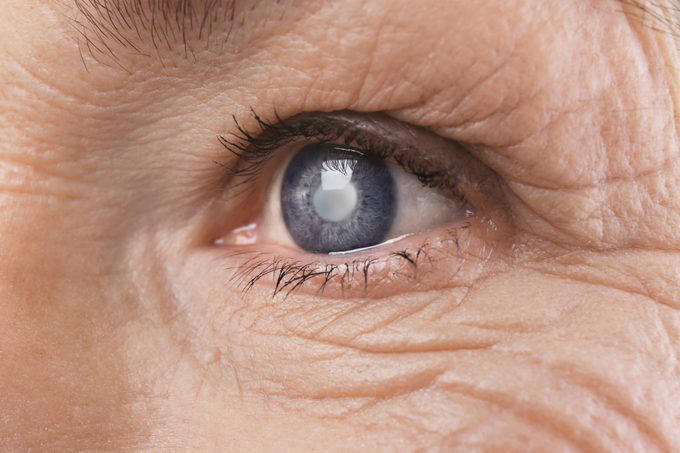 16 Possible Causes of Blurry Vision, According to Eye Health Experts
