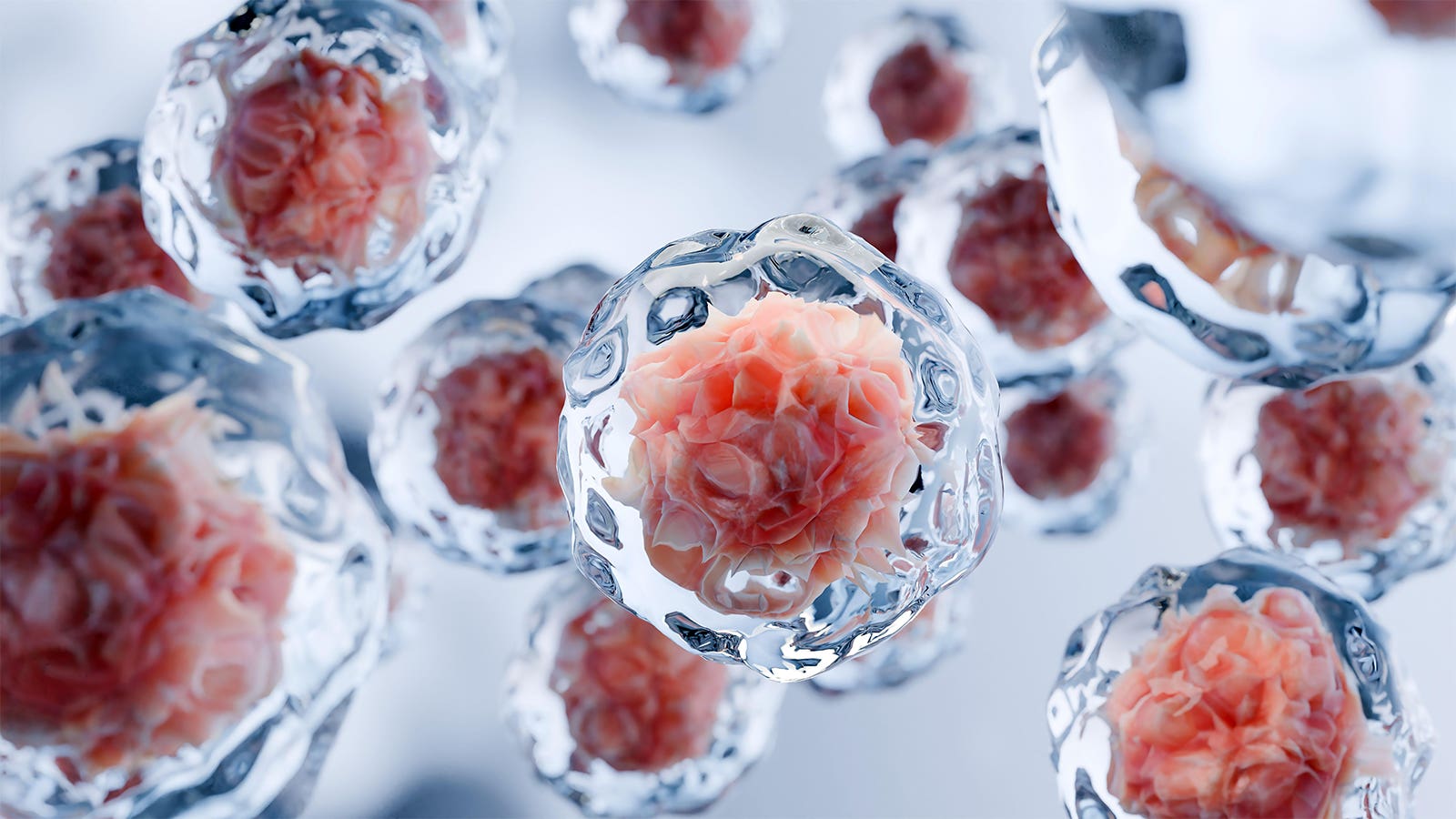 Stem Cell Therapy Begins to Emerge as Potential IBD Treatment