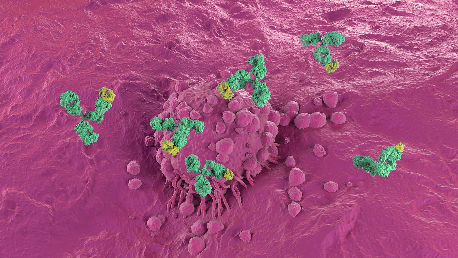 Durable Survival Outcomes in Advanced Melanoma With Neoadjuvant Dual ...