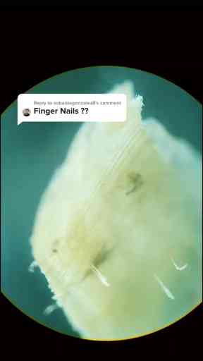 I Know You Wanted a Fingernail... But...