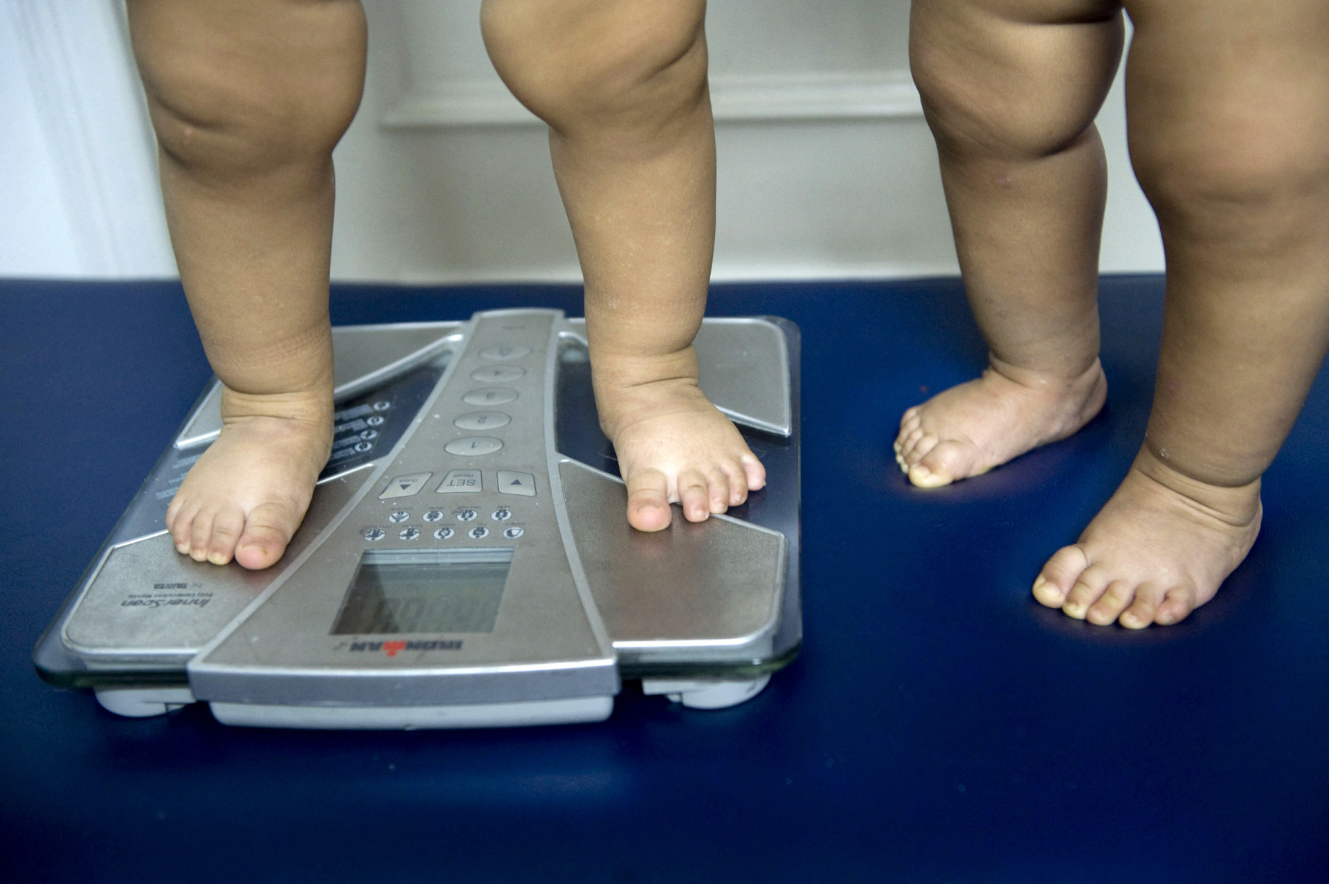 Childhood obesity: causes, and how to fight it