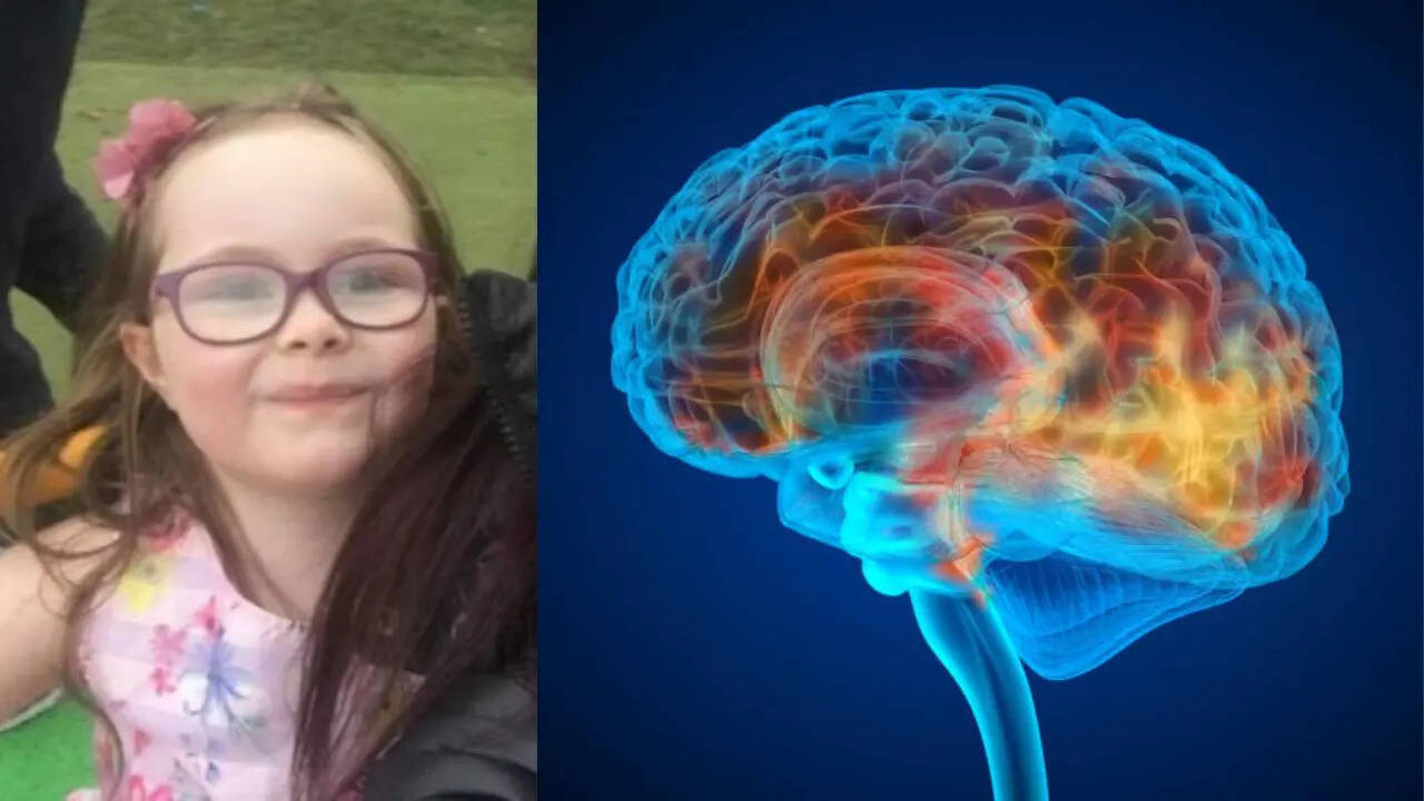 A Healthy 10-year-old Dies of a Rare Brain Infection a Decade After She ...