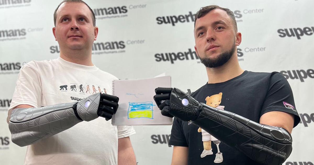 Wounded Ukrainian soldiers with bionic arms want to return to the front lines