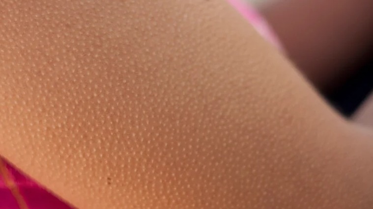 What are Goosebumps and why do we get them?