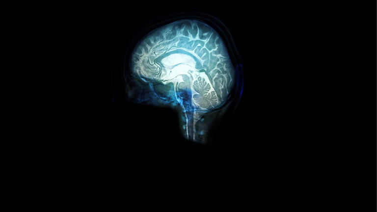 Brain surgery for mental illness is making a comeback. But these are ...