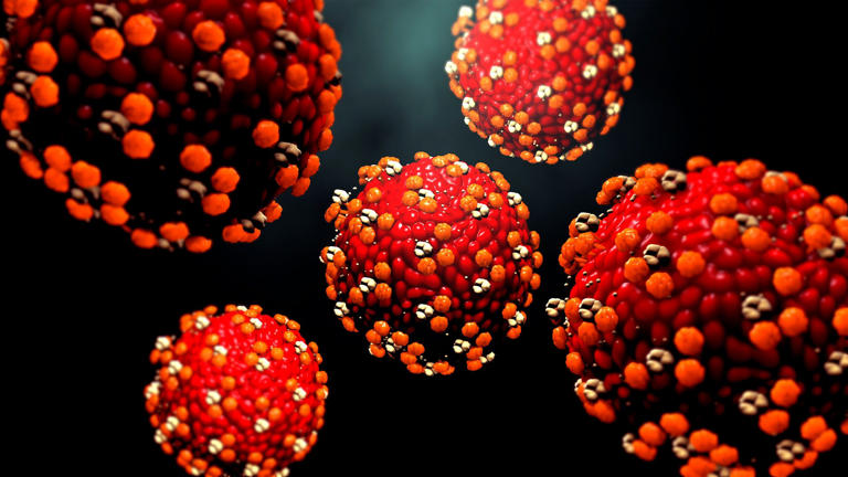 U-M Health Sparrow says it is 1st Michigan hospital to develop measles ...