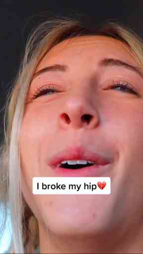 I Broke My Hip… Here’s What Really Happened