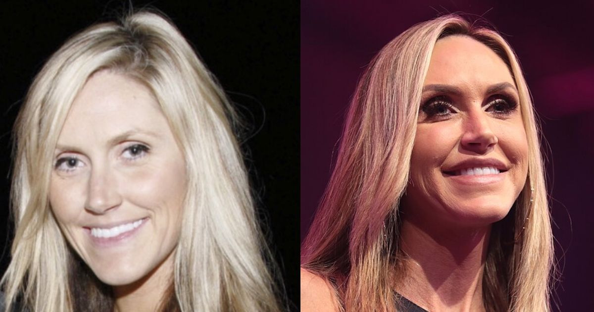 “Cookie‑Cutter Blowup Doll”—Lara Trump’s Alleged Cosmetic Enhancements ...