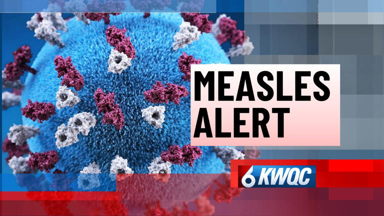 Measles exposure possible at store in Galena