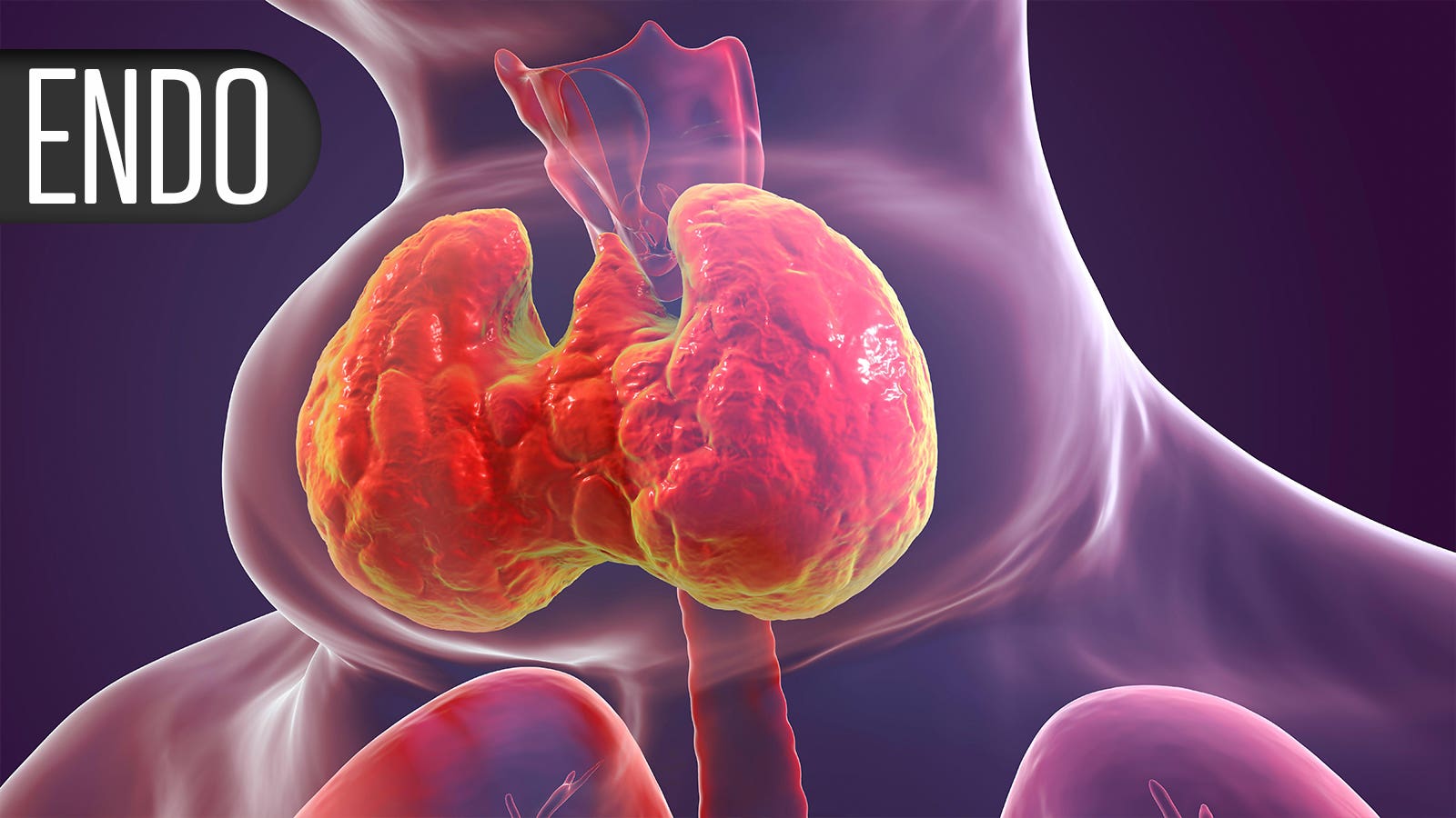 Novel Cushing's Syndrome Drug Improves Hypertension, Hyperglycemia