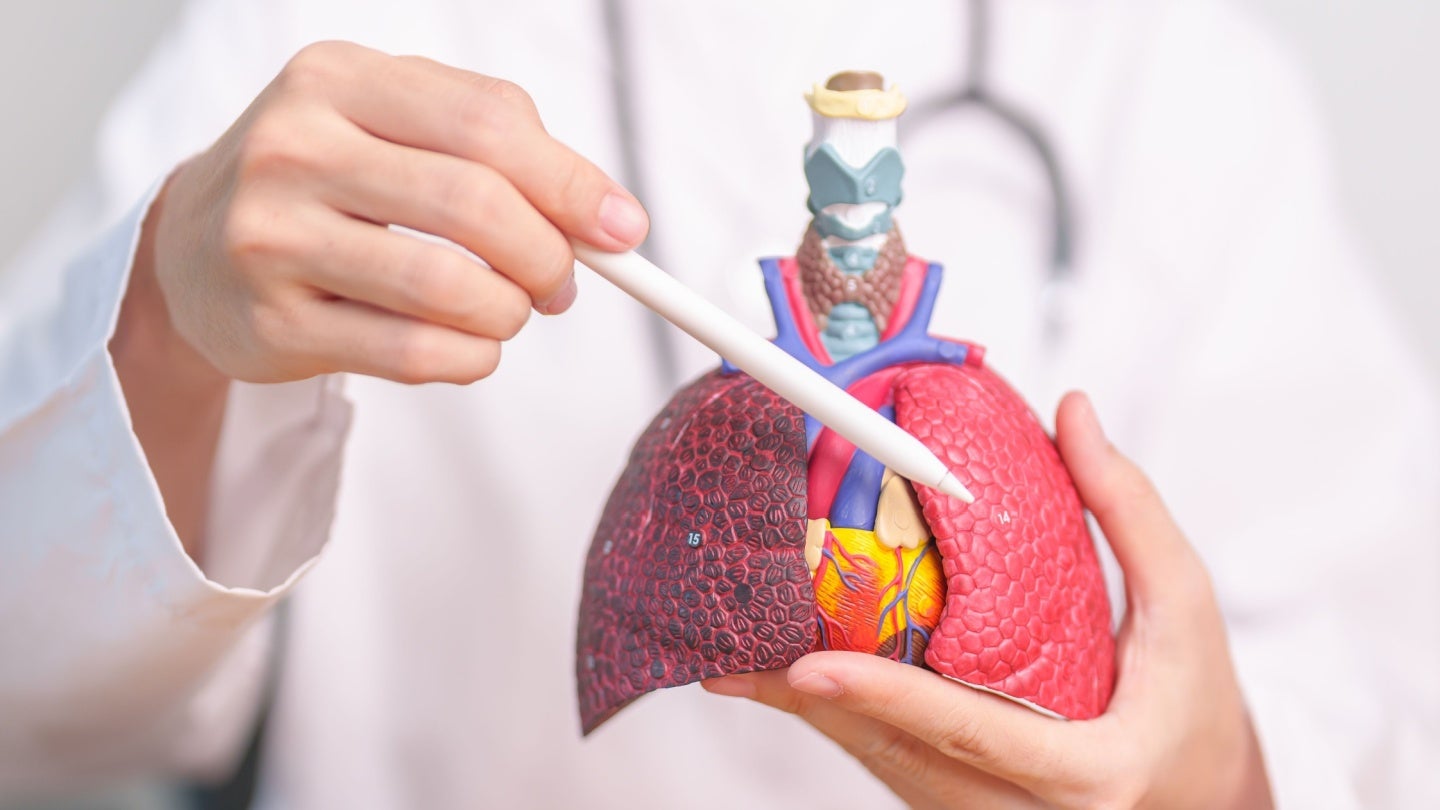 Vertex and NHS England agree reimbursement for Alyftrek