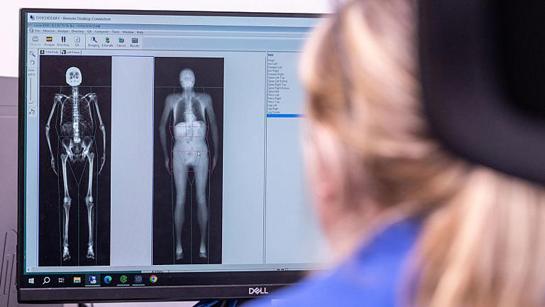 Mass health scan of 100,000 people in the UK could redefine disease ...