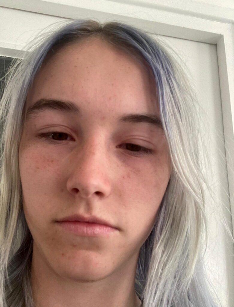 “I have 40+ allergies – including water – I track them on an Excel ...