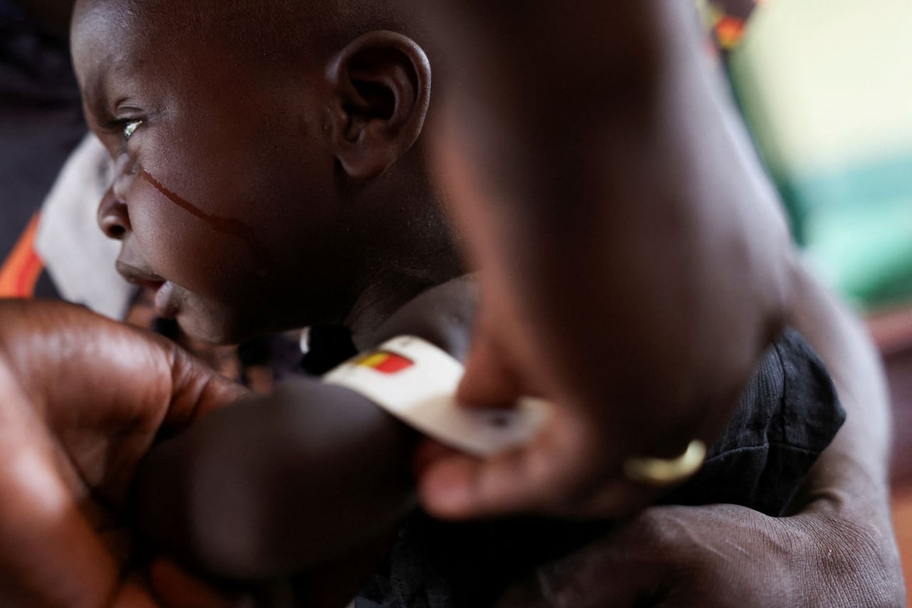 U.S. foreign aid cuts fuelling 'era of global health austerity': study