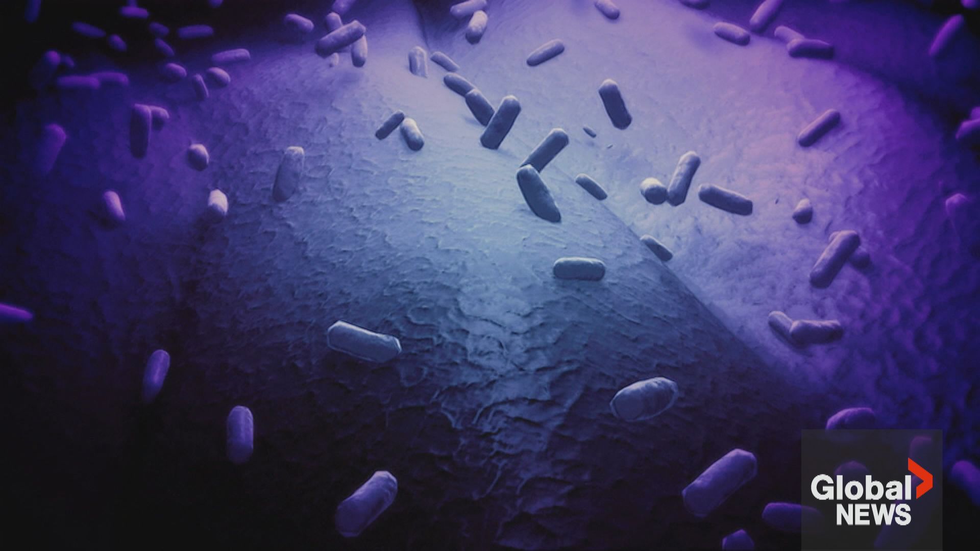 Health Matters: 86 people ill following salami salmonella outbreak