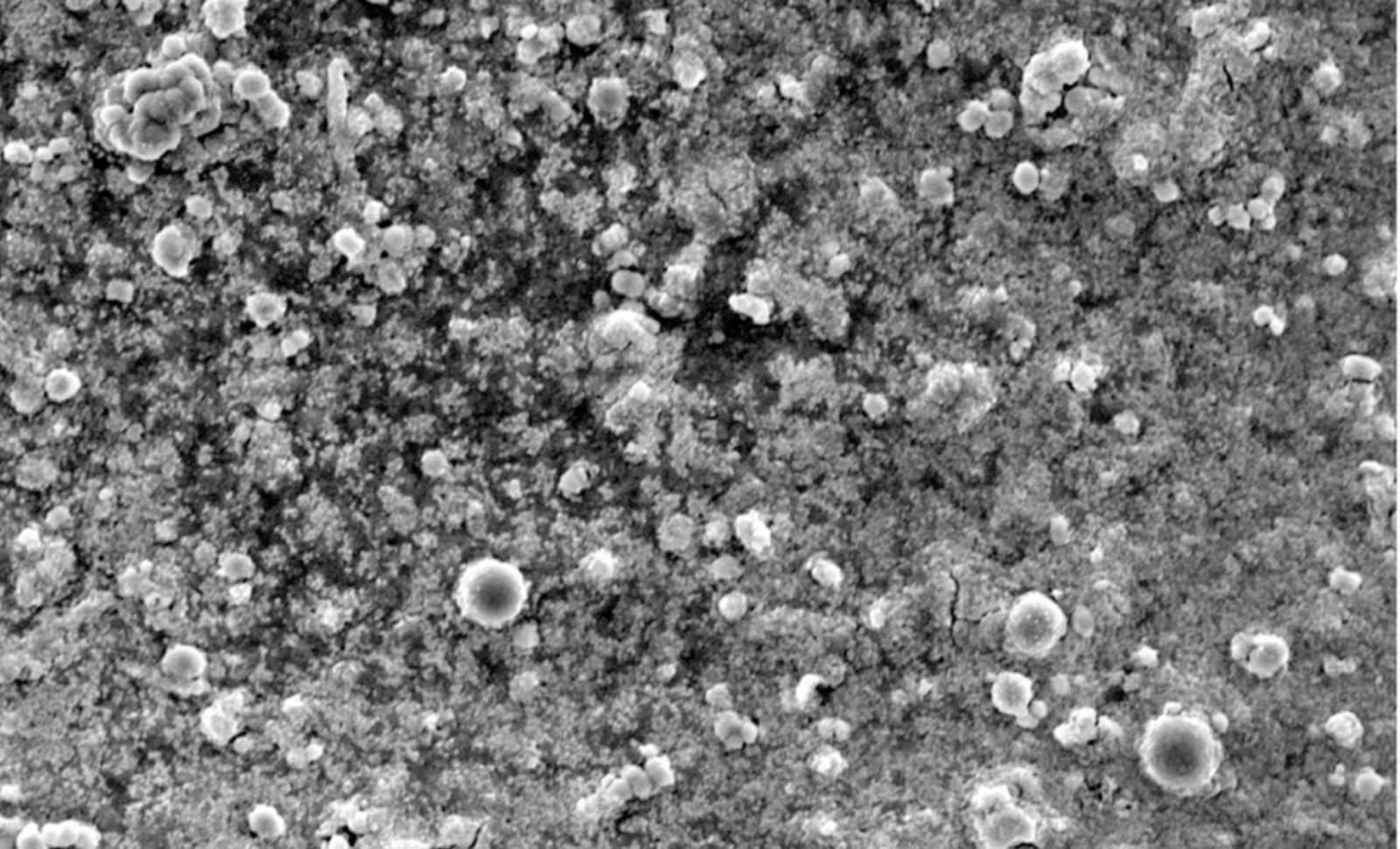 Forget Carbon Capture—This Bacteria Turns CO₂ Into Rock in Just Hours