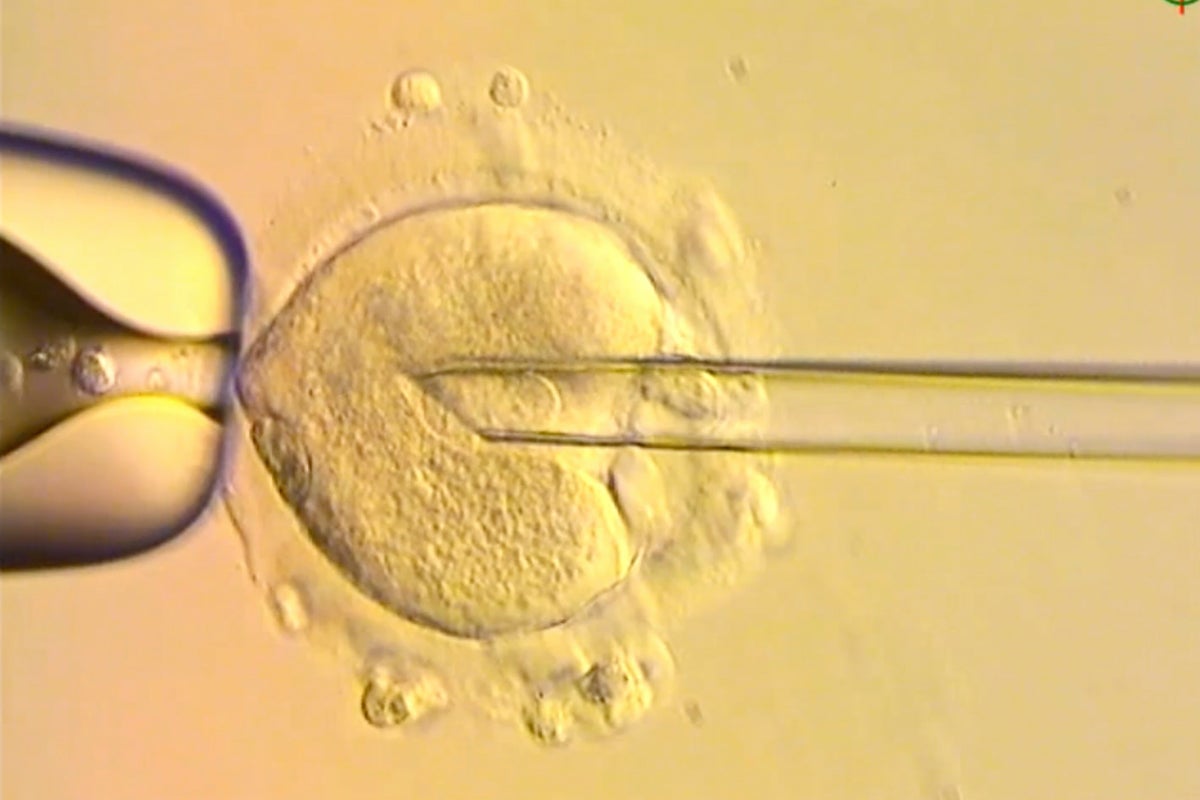 IVF technique using DNA from three people sees eight babies born free ...