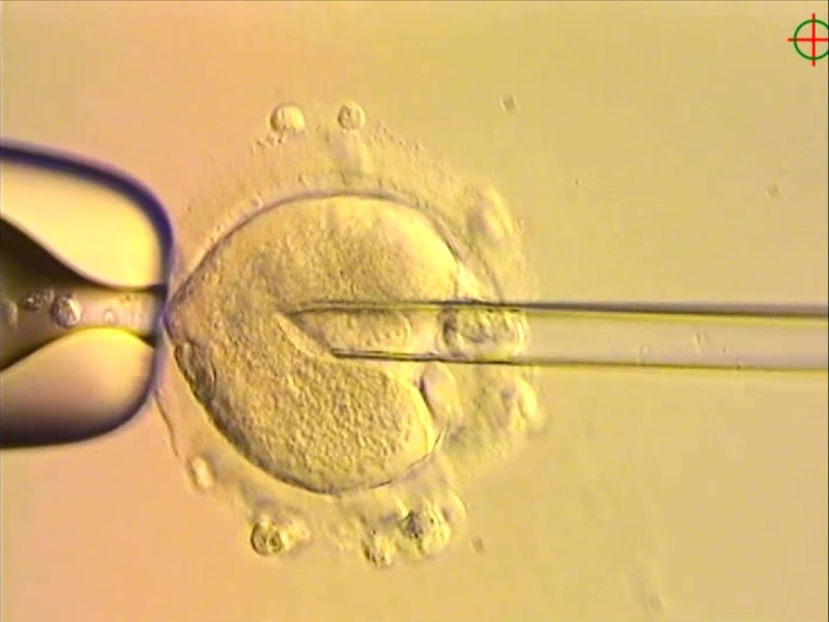 Three-parent babies born using pioneering IVF treatment to prevent ...