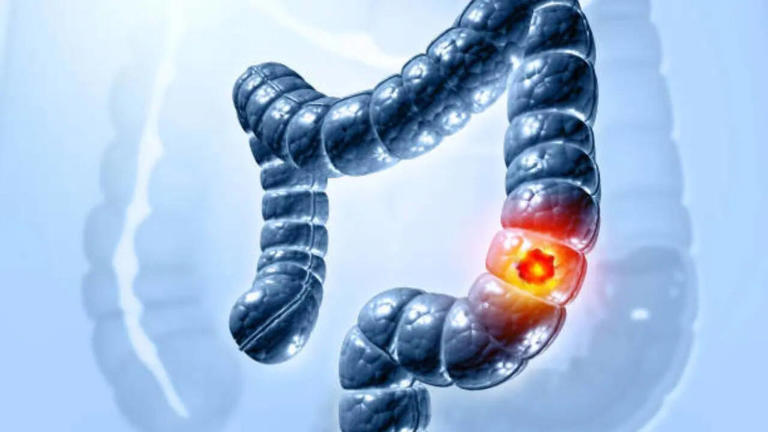 THIS Is the Best Time to Eat Nuts To Strengthen Your Gut, Reveals ...