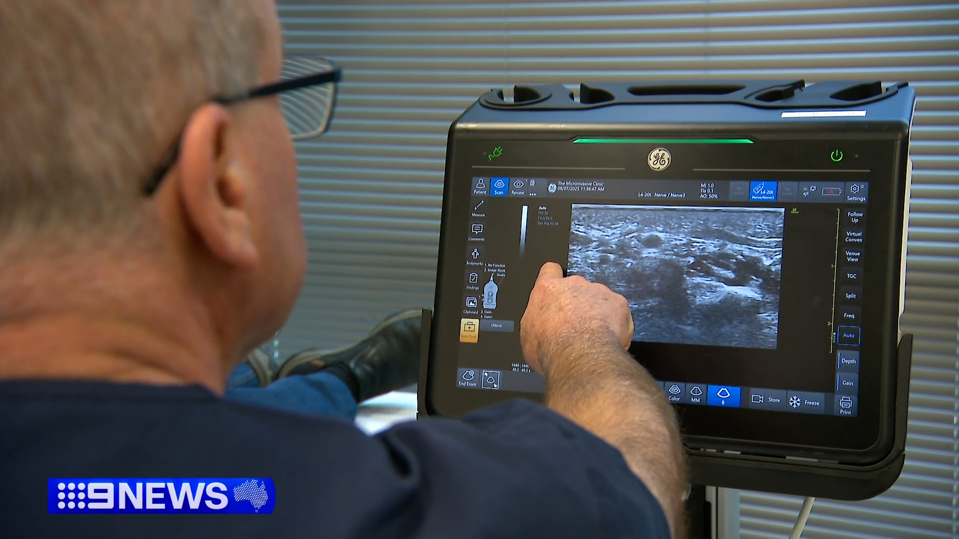 Aussie doctor pioneering game-changing treatment for common condition