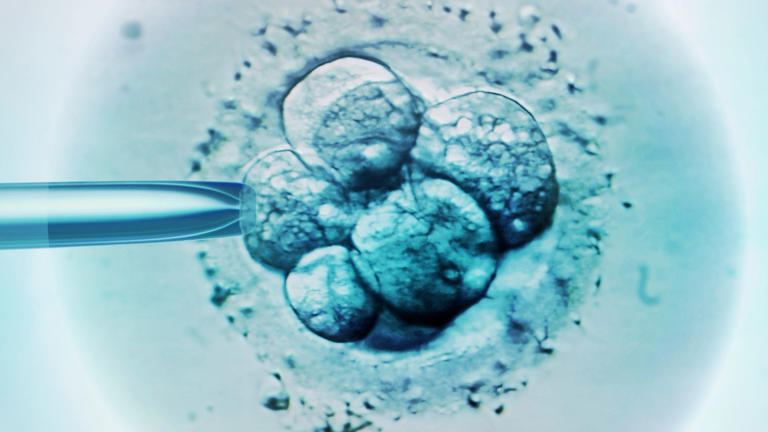 IVF breakthrough using 3‑person DNA leads to 8 babies born free of ...