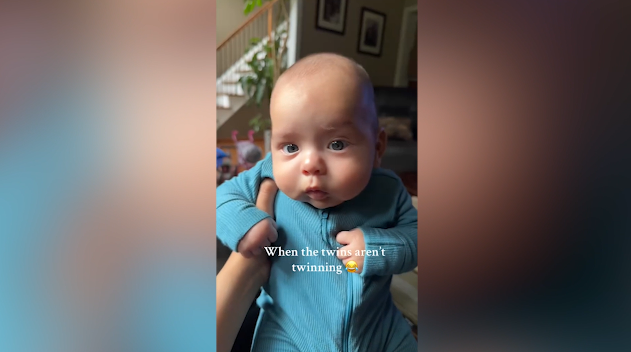 Mom Gives Birth To Twins, Unprepared For How They Look 4 Months Later