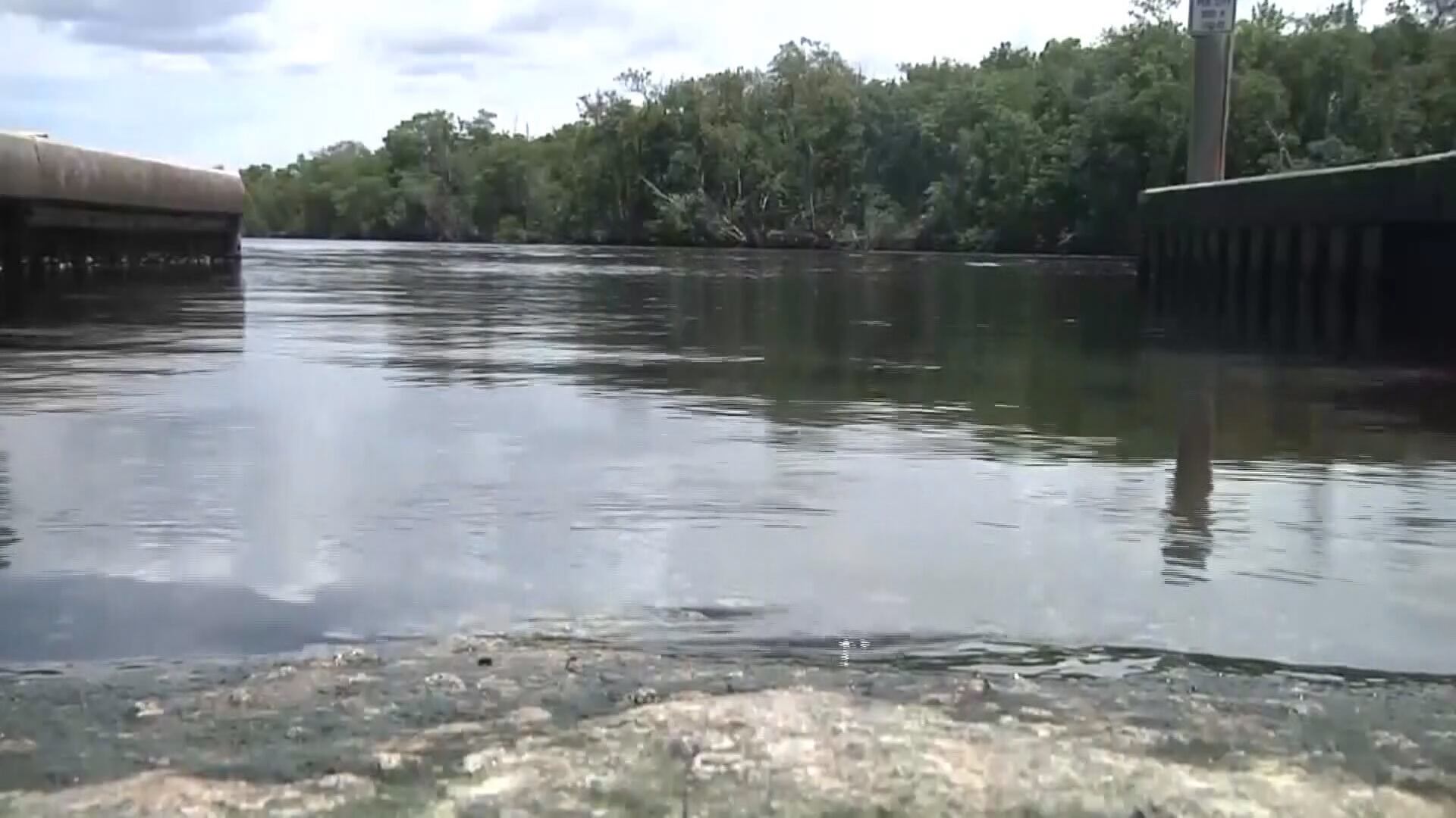 State Department of Health releases statement on flesh-eating bacteria