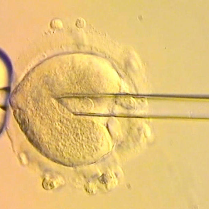 8 babies born with DNA from 3 people in world-first IVF trial