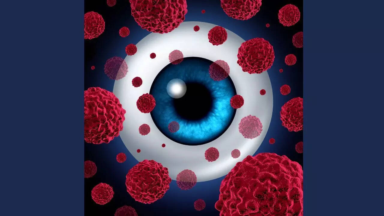 Eye cancer common signs and symptoms that you should know