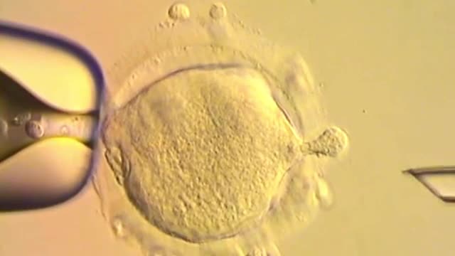 Pioneering IVF technique which created eight healthy babies unveiled by ...
