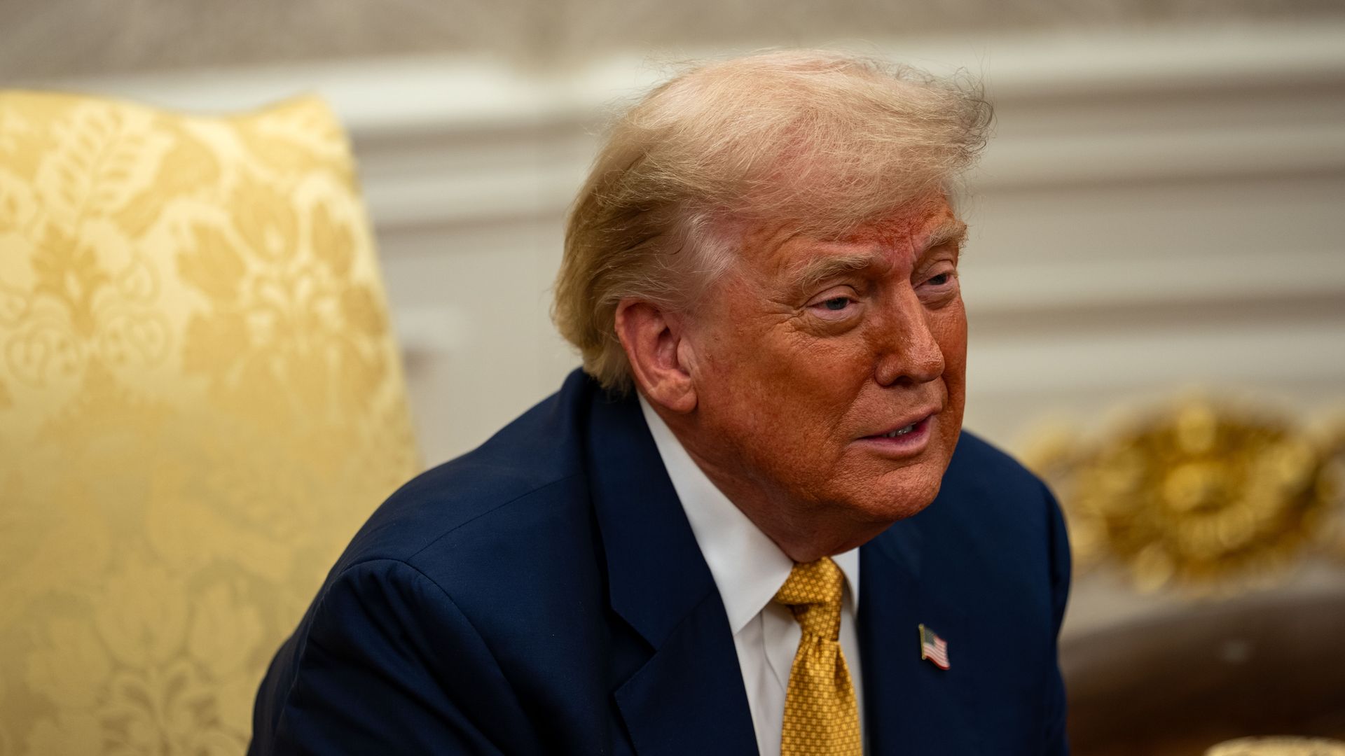 Donald Trump's health diagnosis confirmed as 'chronic' vein disorder ...