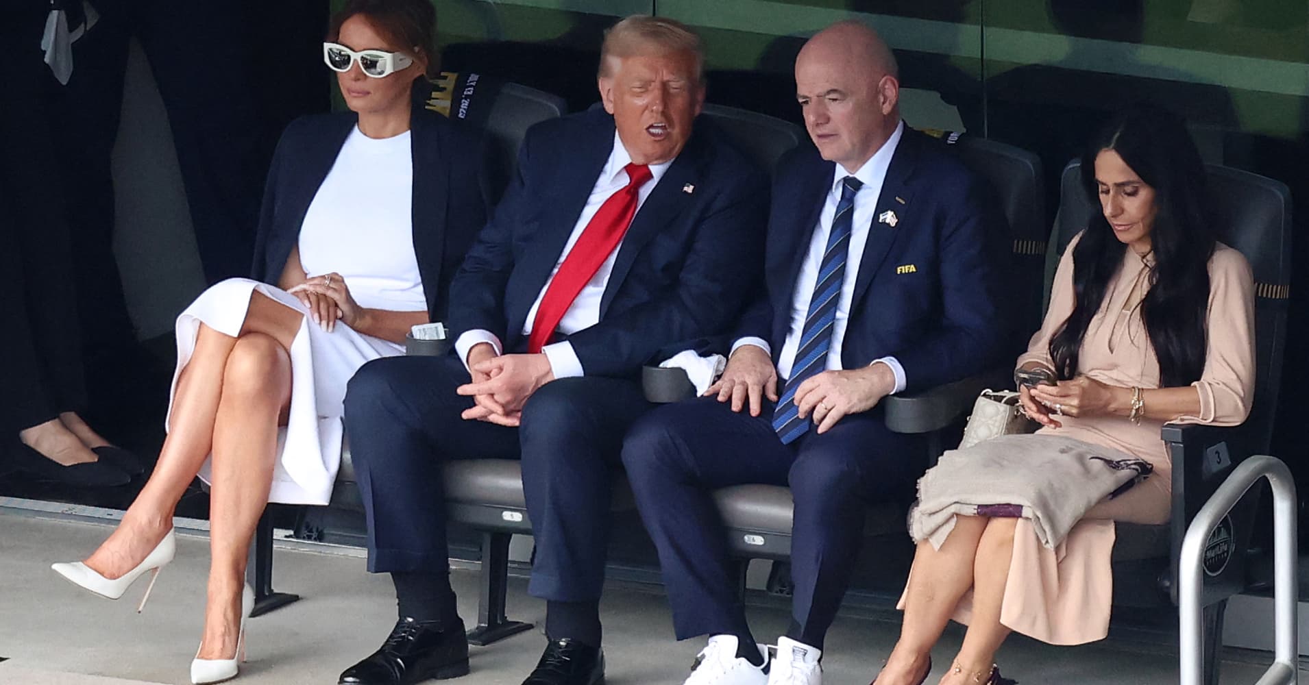 Trump diagnosed with common vein condition after ankle swelling raises ...