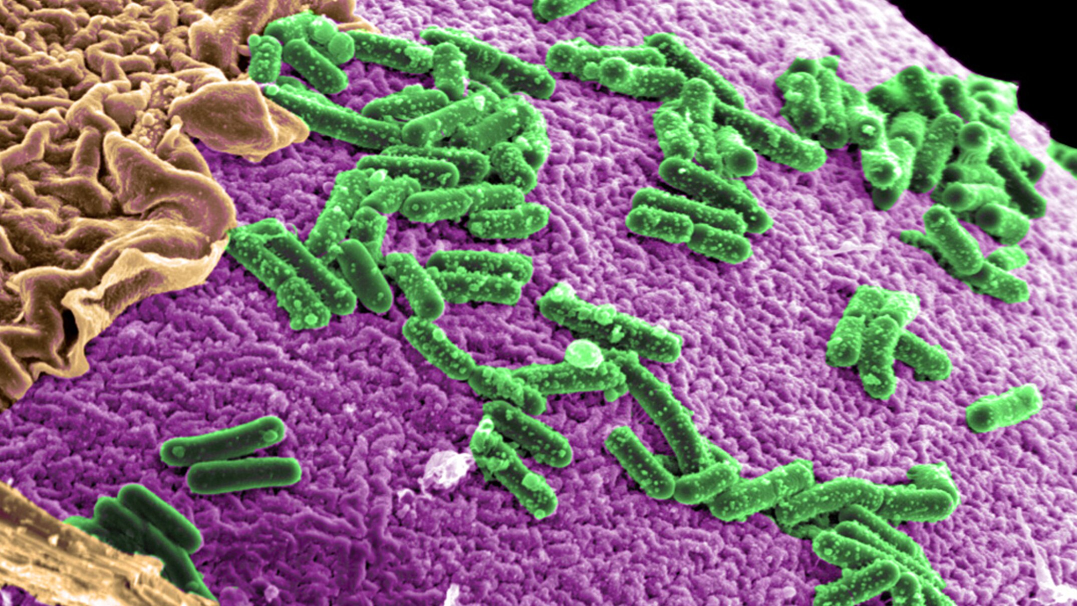 Genetically modified bacteria tested in humans stayed in guts of some ...