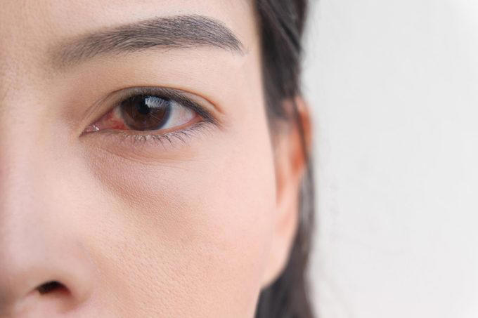 16 Possible Causes of Blurry Vision, According to Eye Health Experts