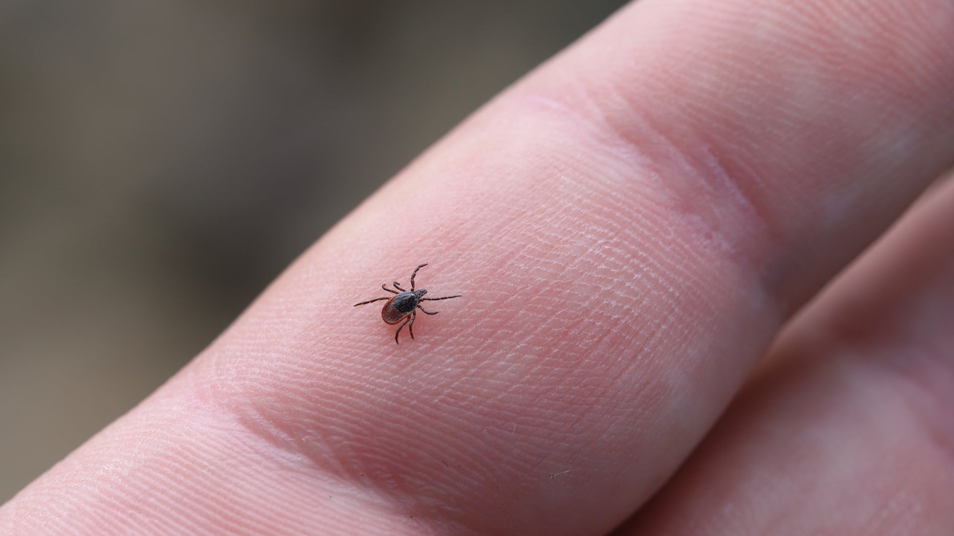 Tick That Causes Red Meat Allergy Spreading Across U.S.